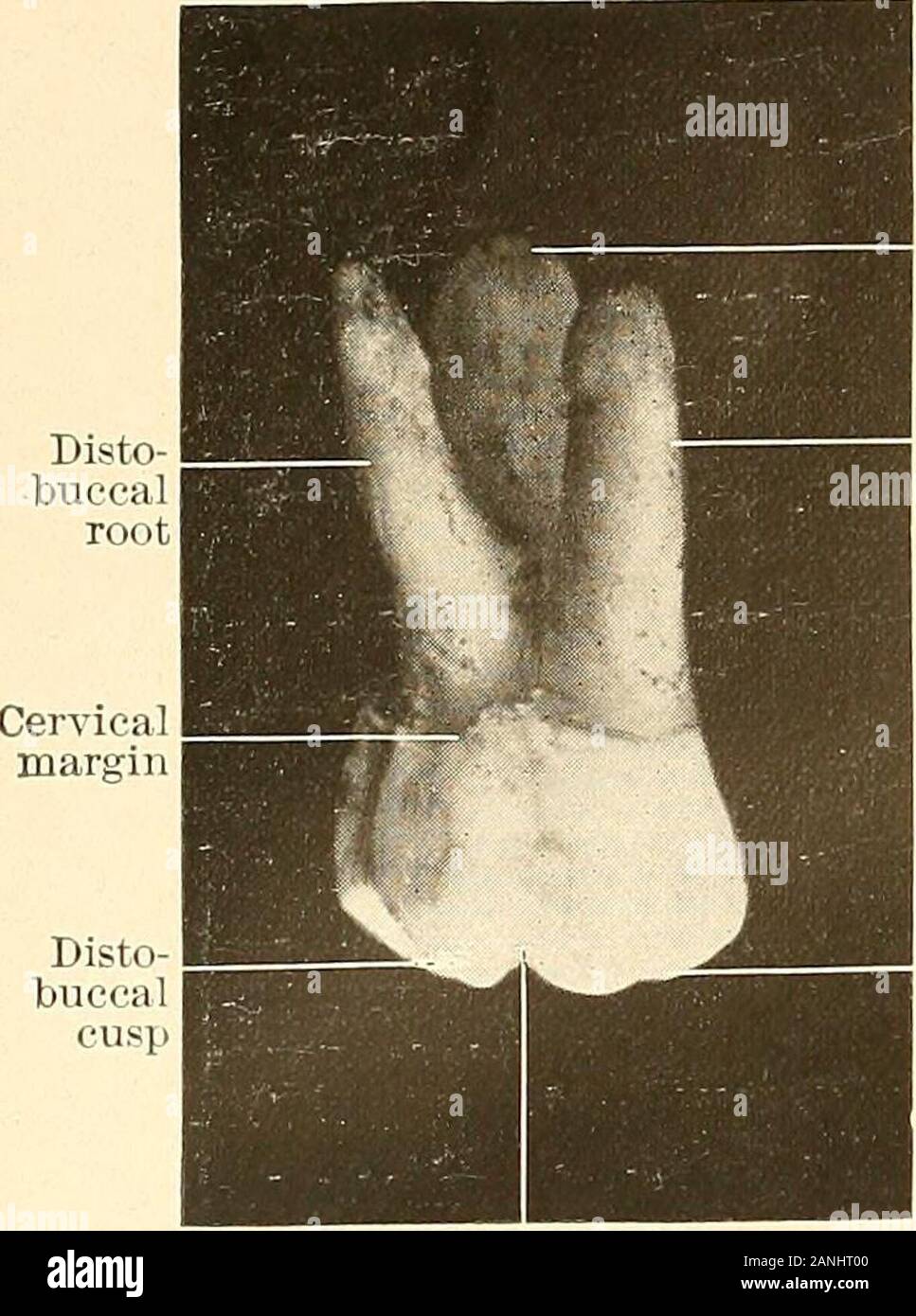 Principles and practice of operative dentistry . Fig. 51.—Inferior ...