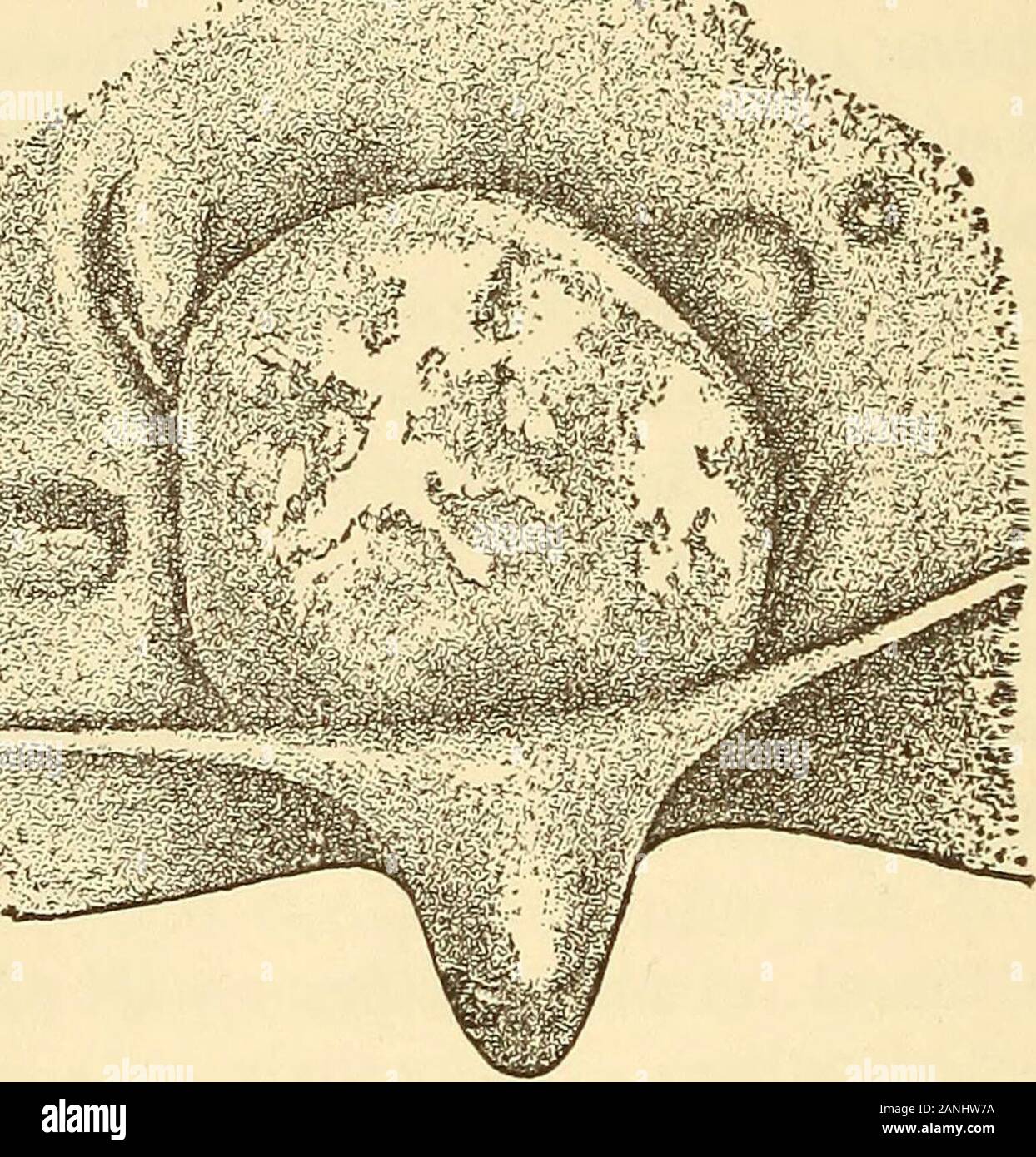 Nasopharynx tumor hi-res stock photography and images - Alamy
