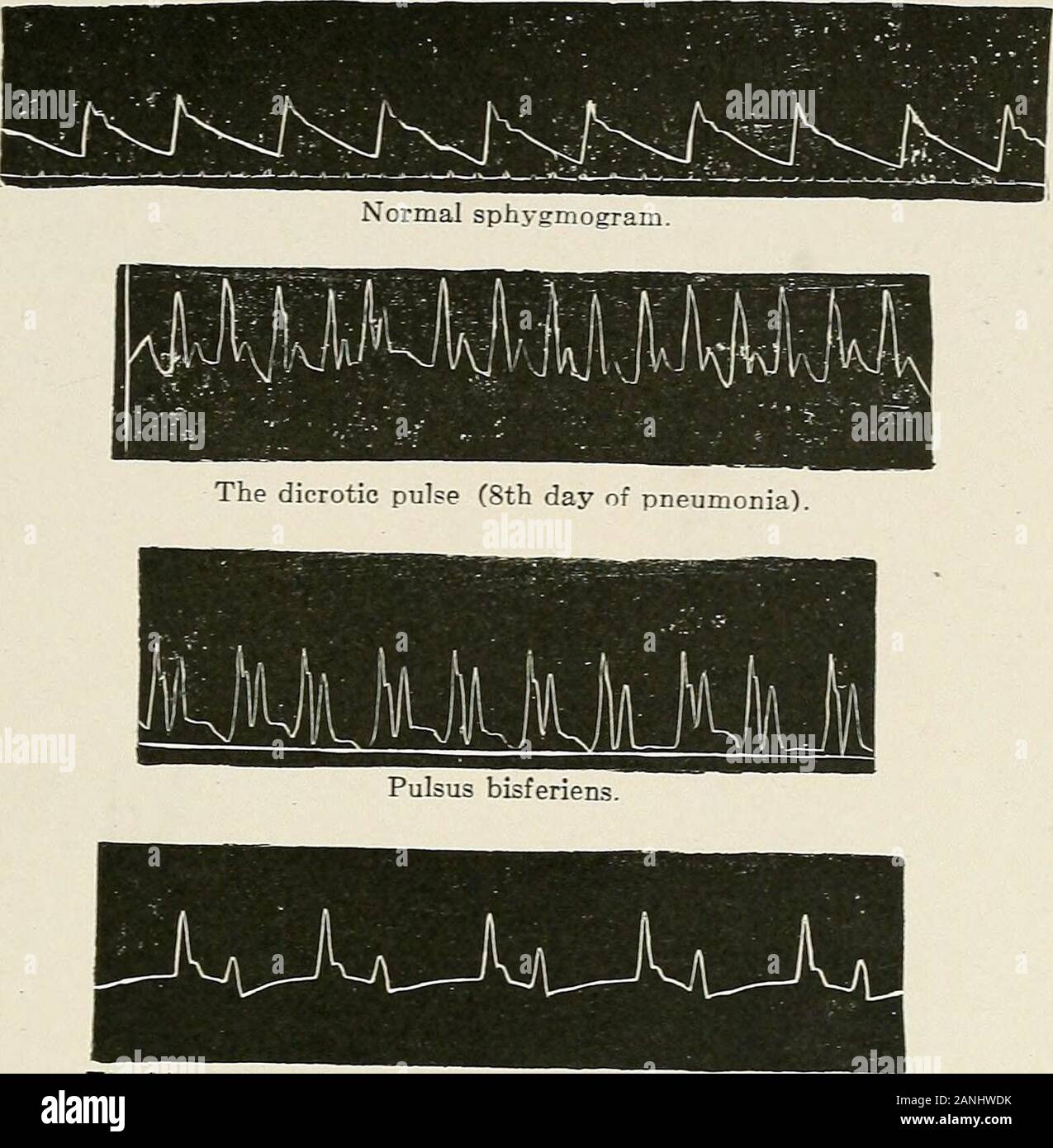 Diseases of the chest and the principles of physical diagnosis ...