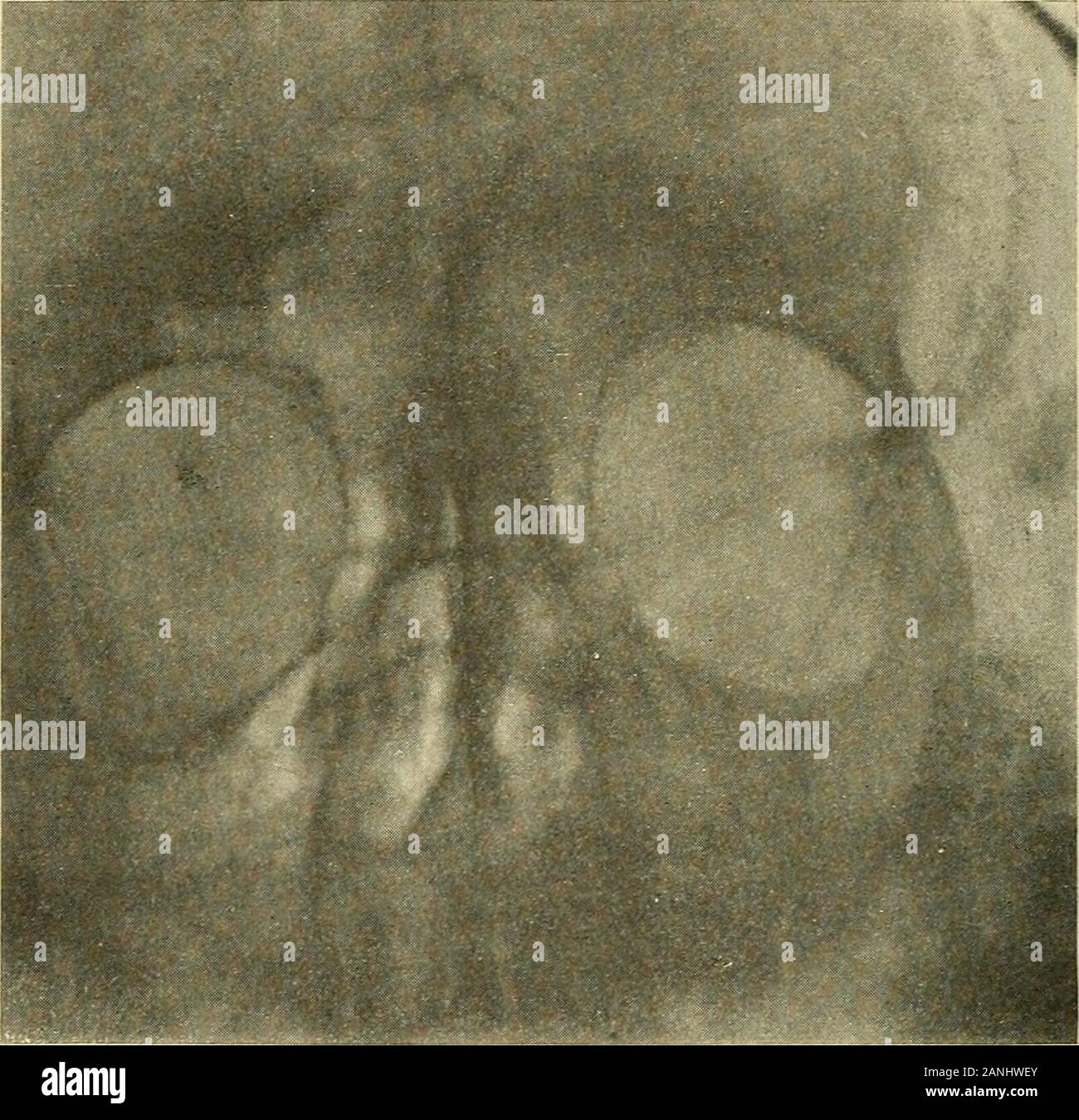 Celerated hi-res stock photography and images - Alamy