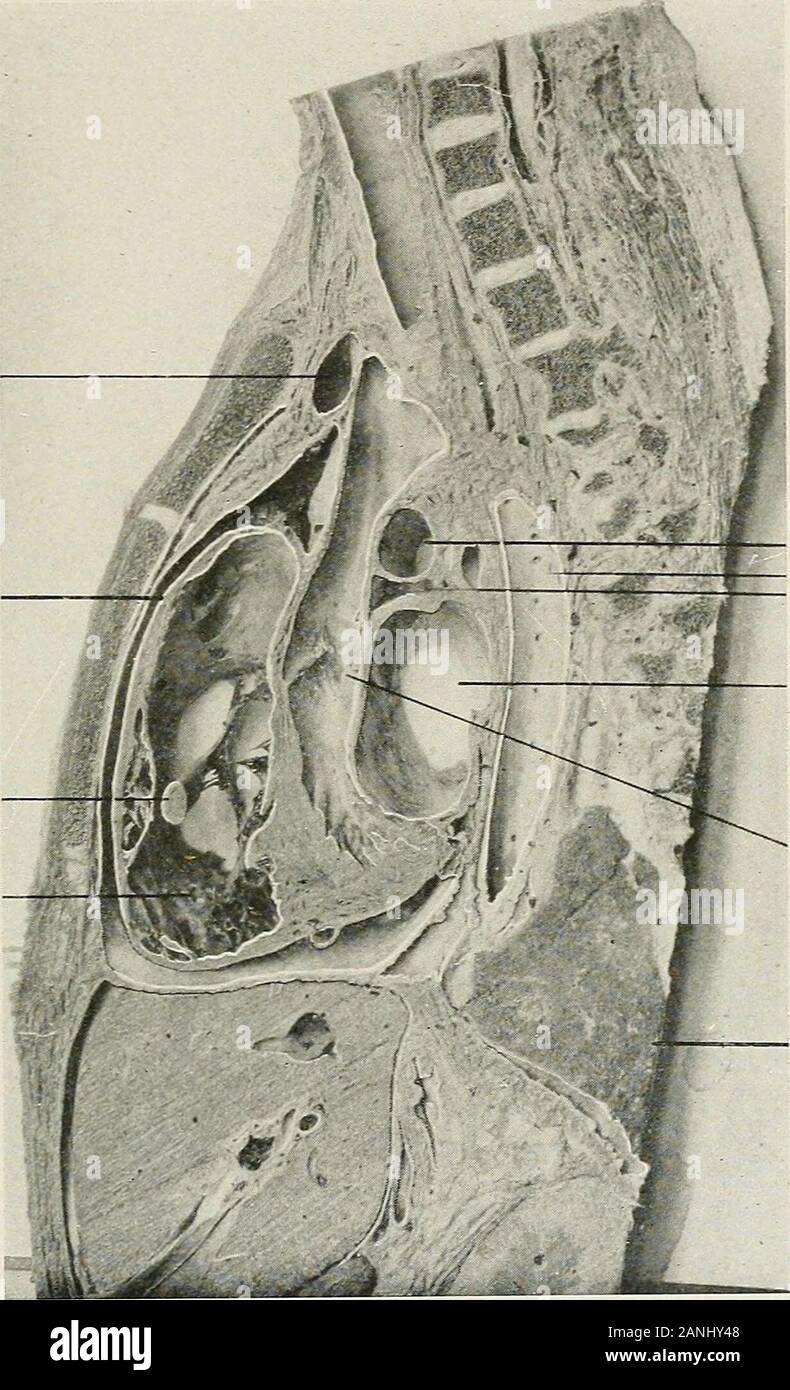 Diseases of the chest and the principles of physical diagnosis . ior ...