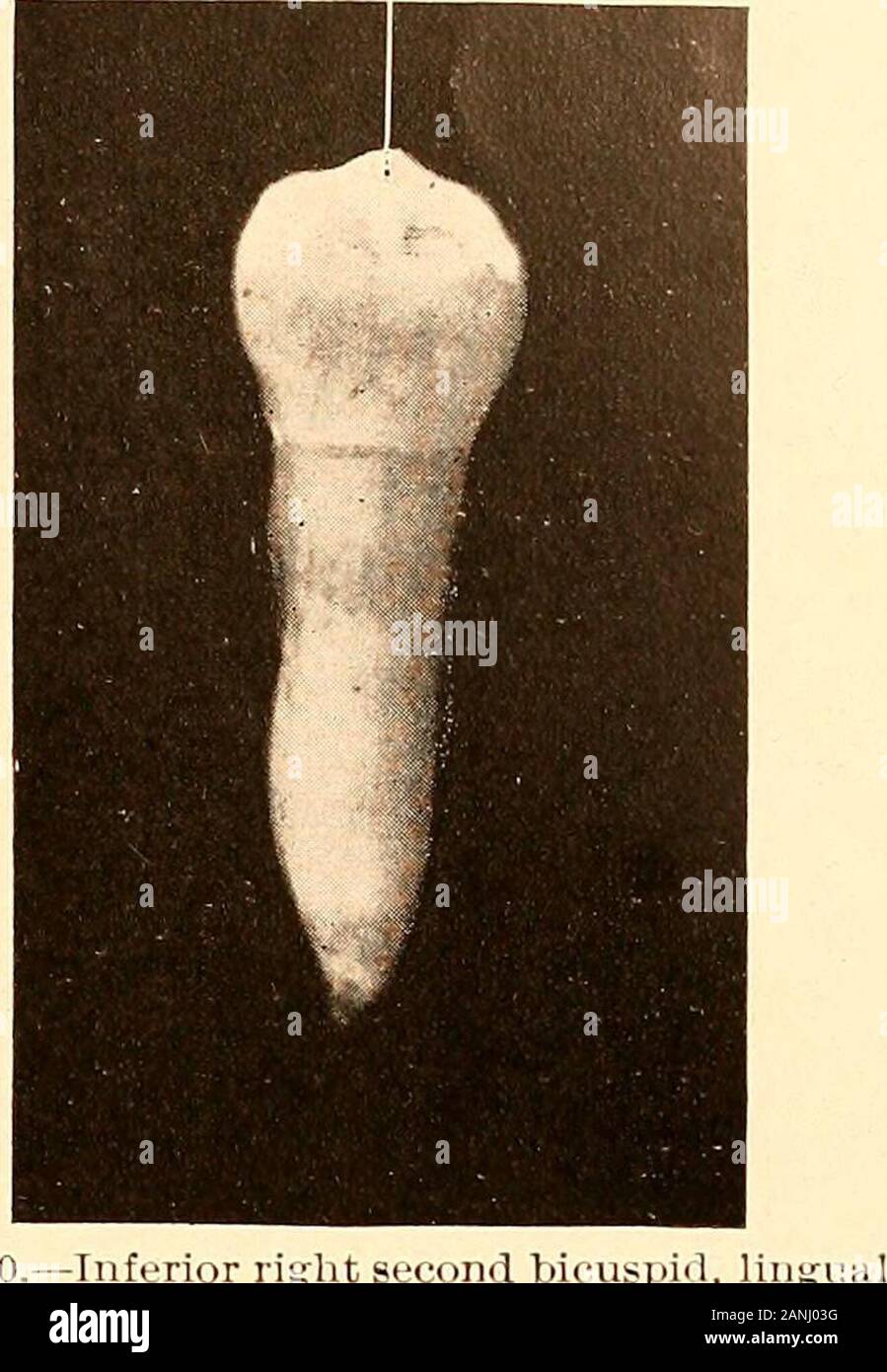 Principles and practice of operative dentistry . -Inferior right second ...