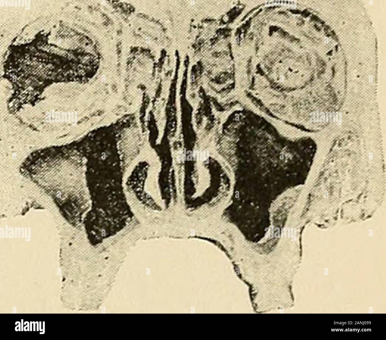 Oral surgery; a text-book on general surgery and medicine as applied to ...