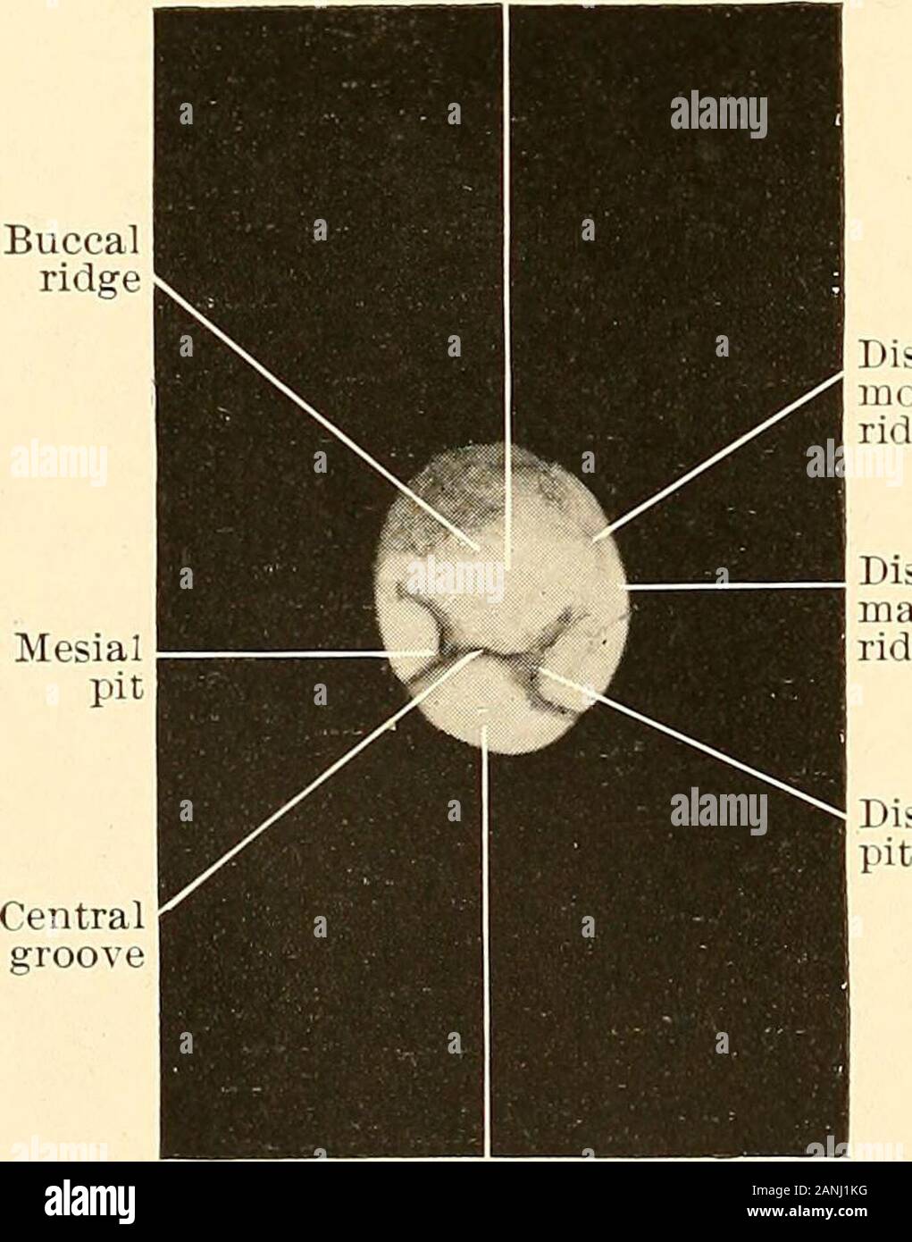 Principles and practice of operative dentistry . Fig. 45.—Inferior ...