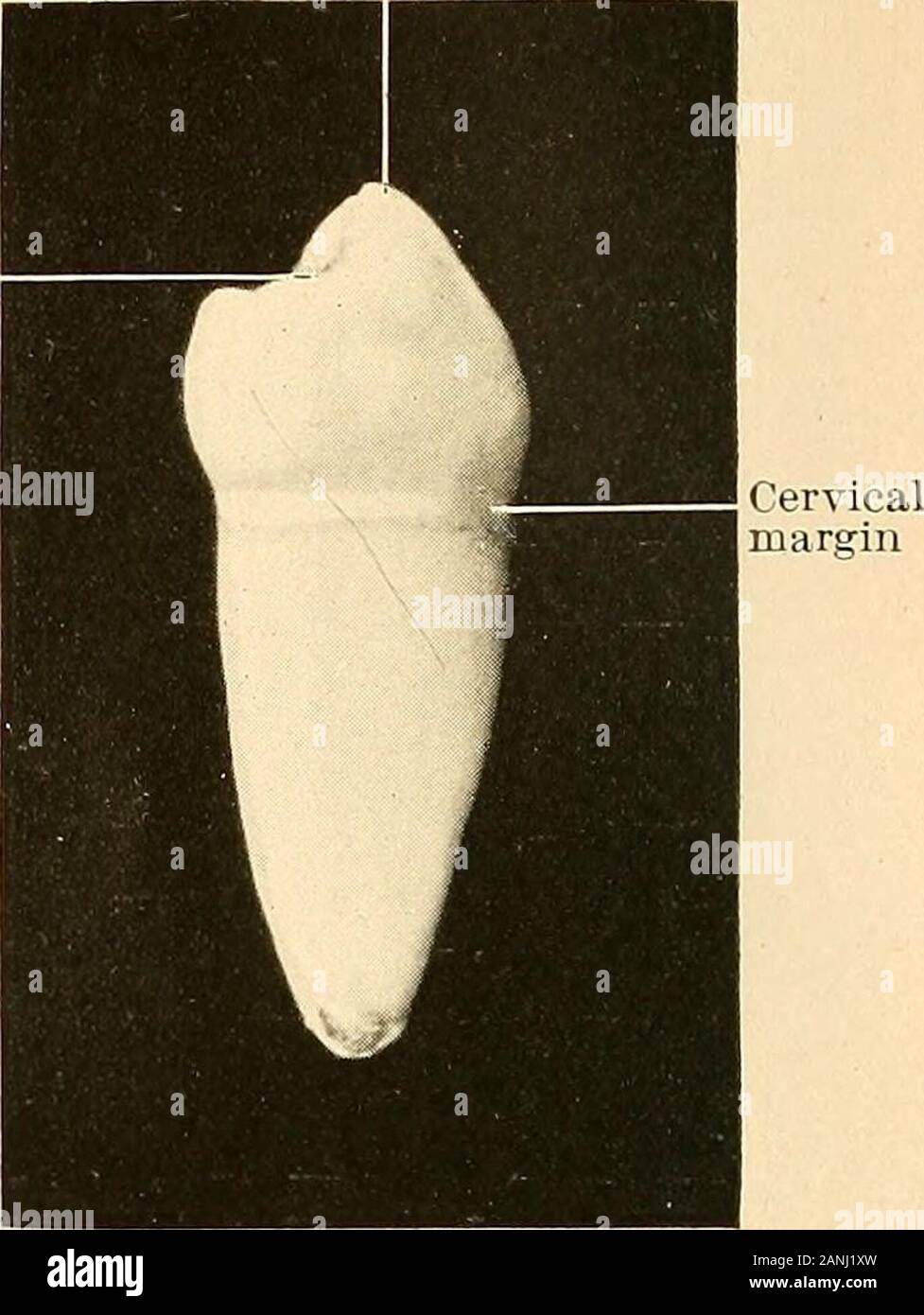 Disto hi-res stock photography and images - Alamy