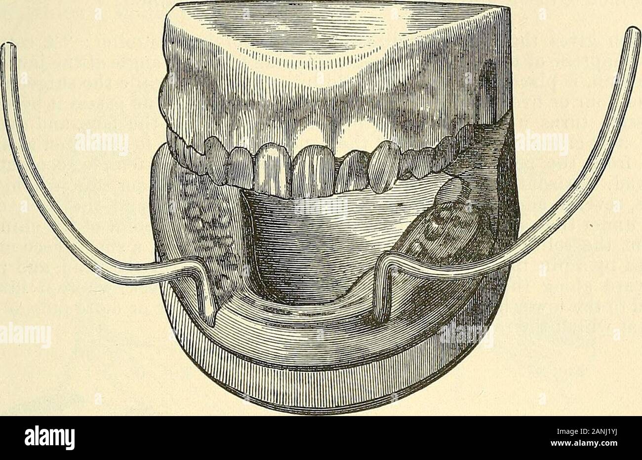 125 impressions hi-res stock photography and images - Alamy