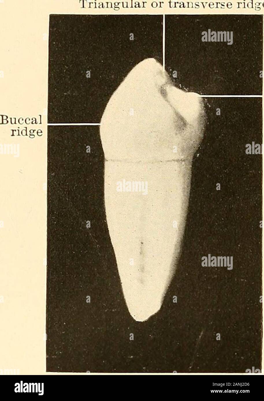 Transverse Ridge Premolar