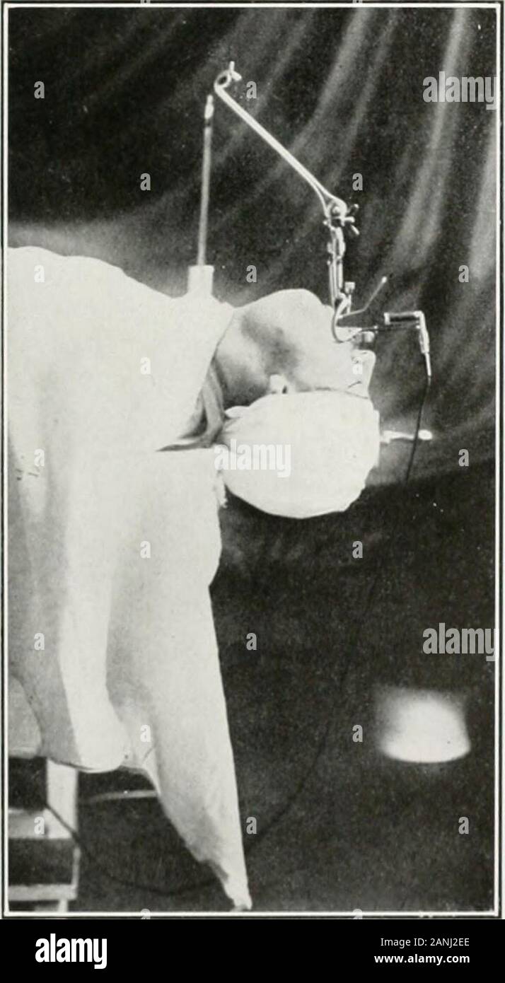 Push endoscopy hi-res stock photography and images - Alamy