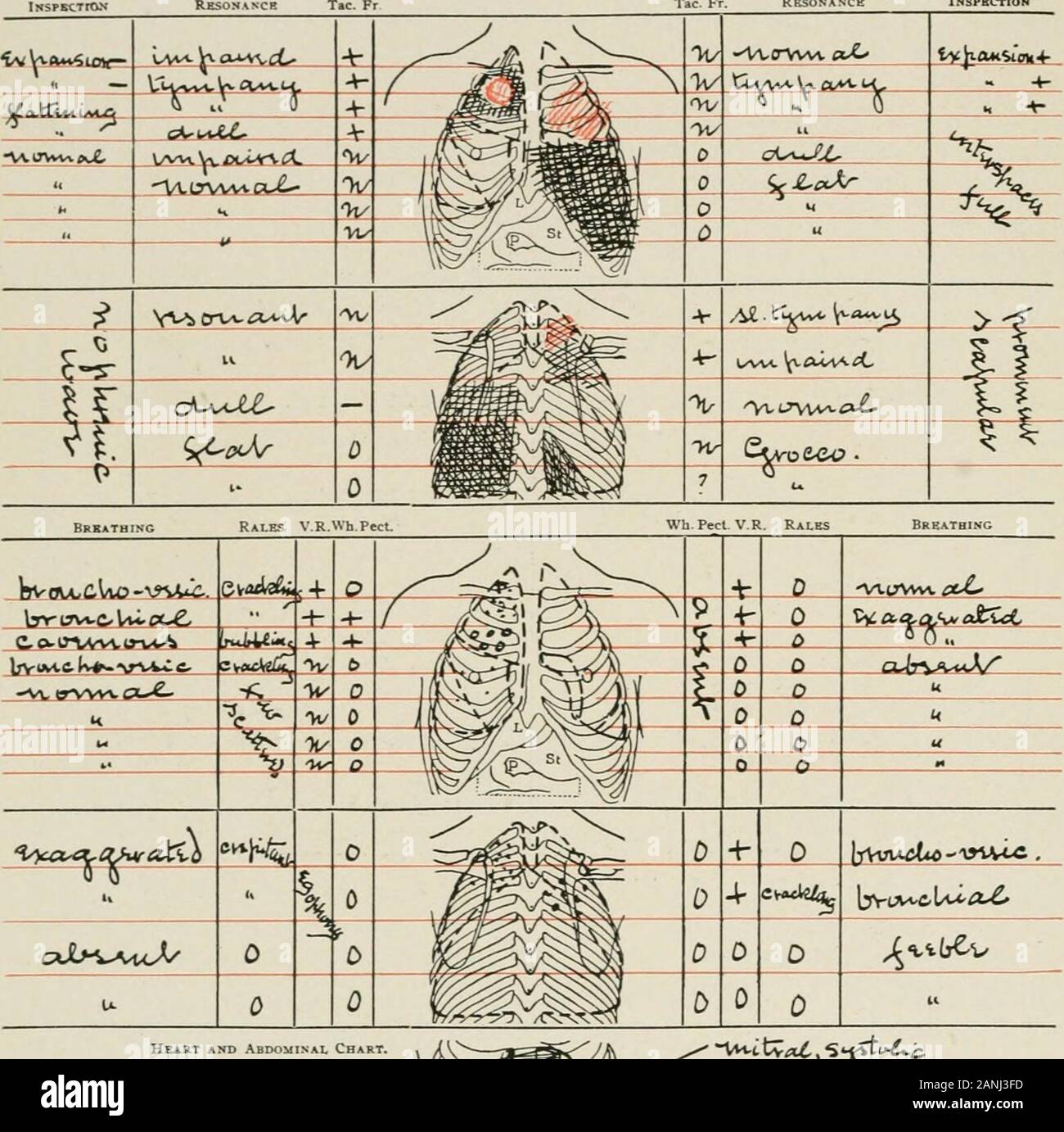 Physical abnormality hi-res stock photography and images - Alamy
