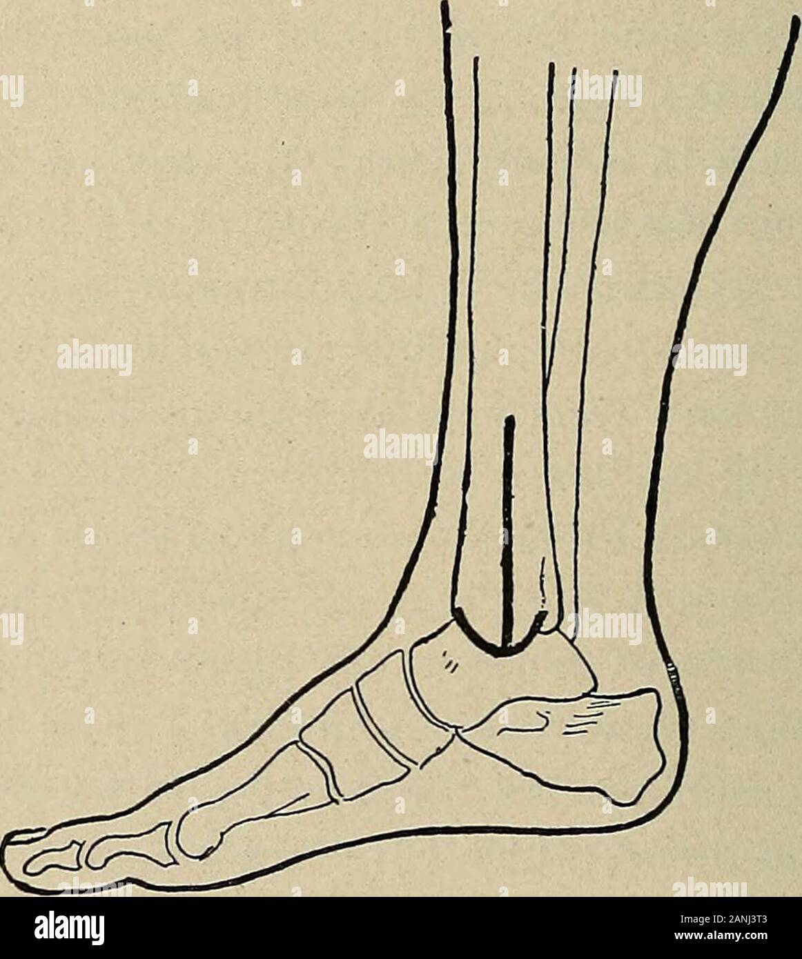 Operative surgery, for students and practitioners . Fig. 353.—Right ...