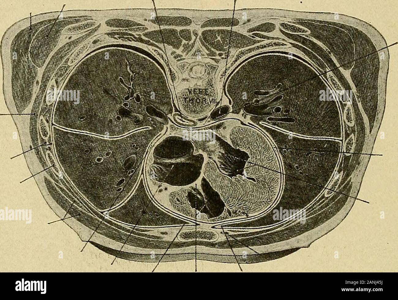 Lateral curvature of the spine and round shoulders . Fig. 6.—Model of ...