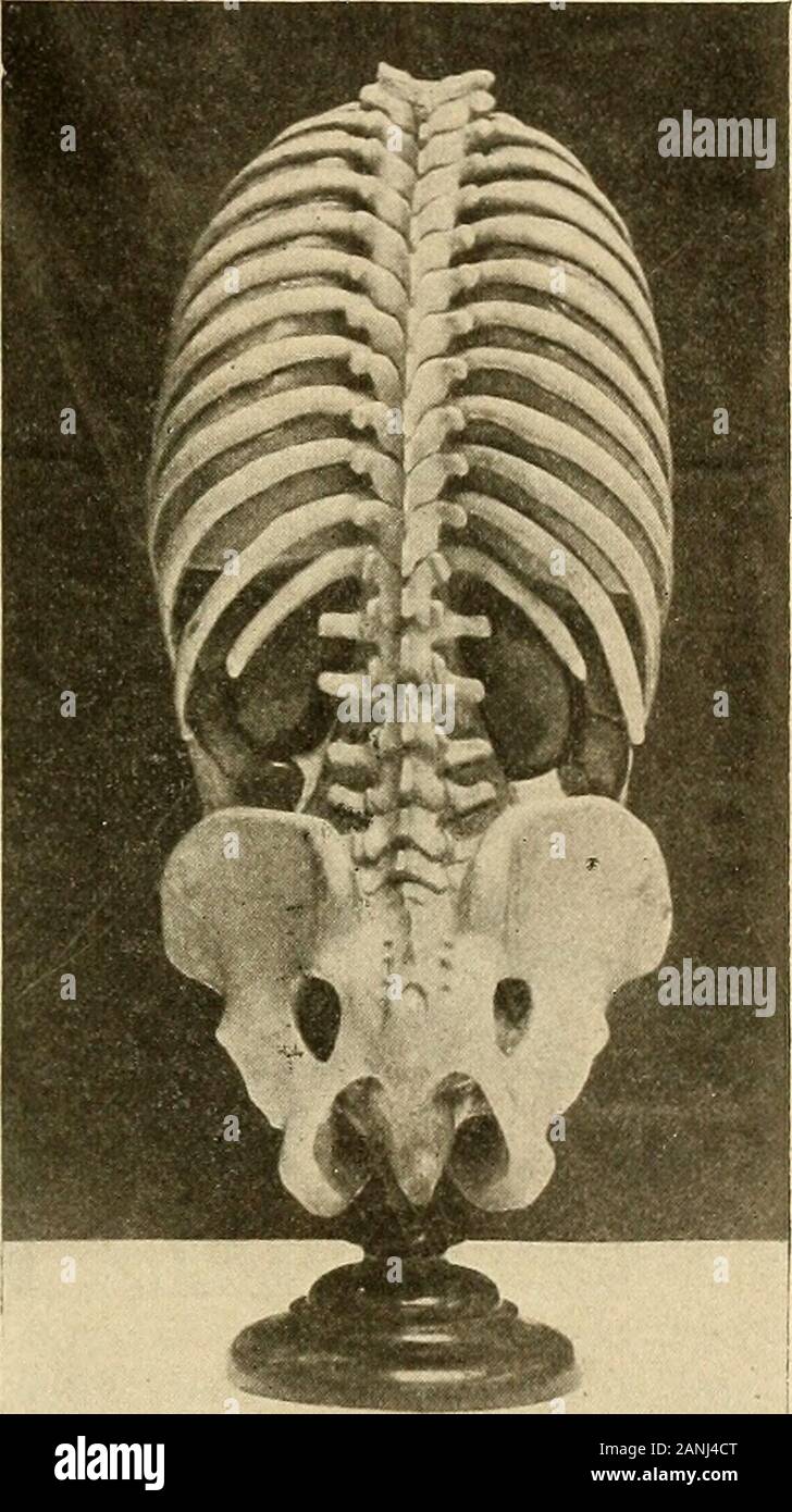 Lateral curvature of the spine and round shoulders . protected against ...