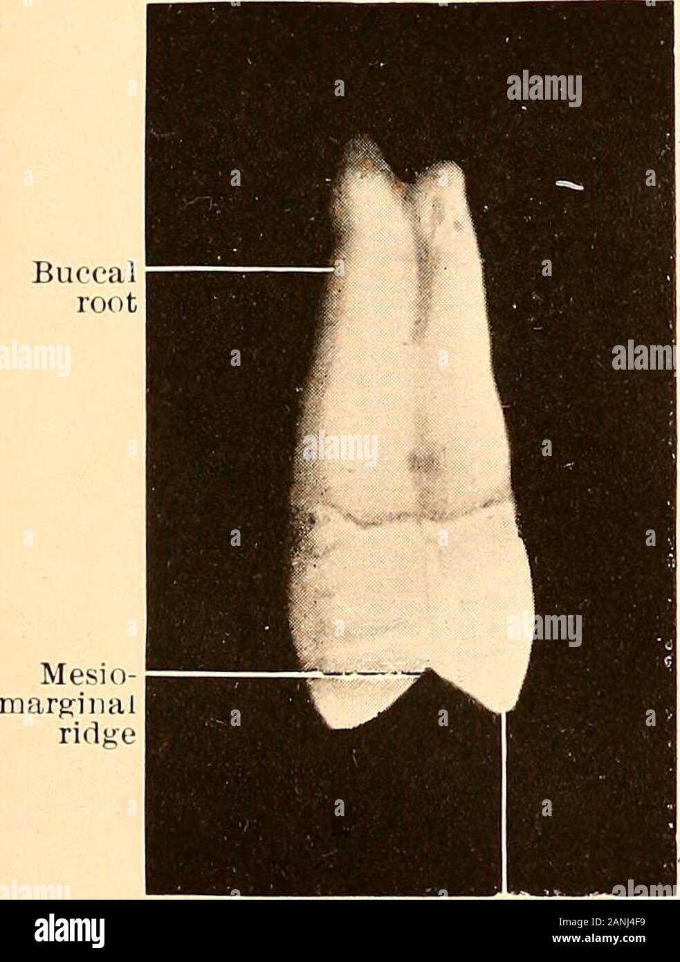 Principles and practice of operative dentistry . iperior right first ...