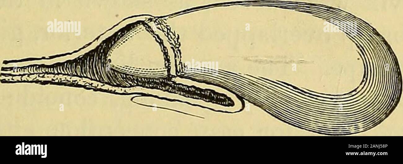 Inverted lip hi-res stock photography and images - Alamy