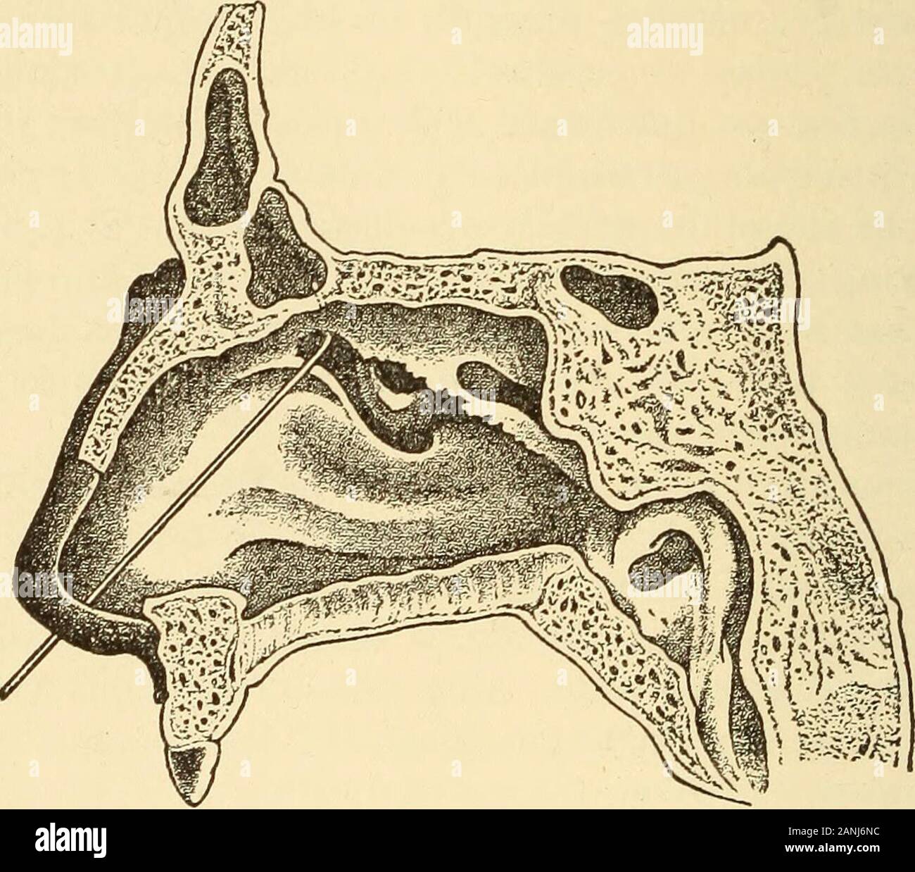 A text-book on diseases of the ear, nose and throat . aemia. Those ...