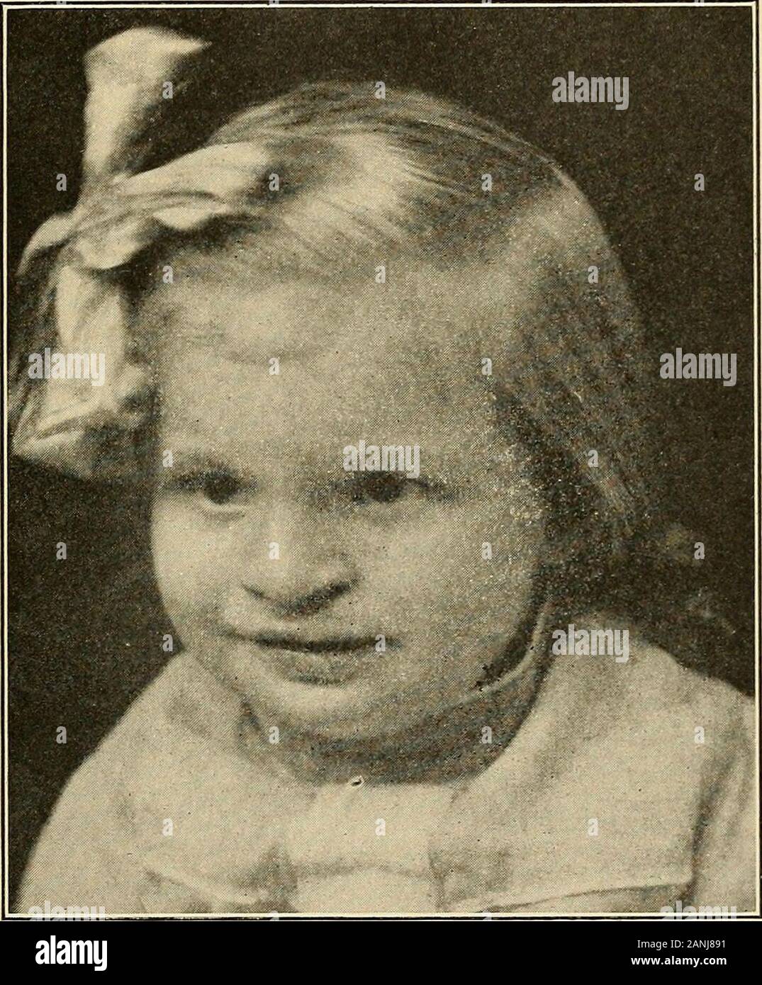 Apex of uvula hi-res stock photography and images - Alamy