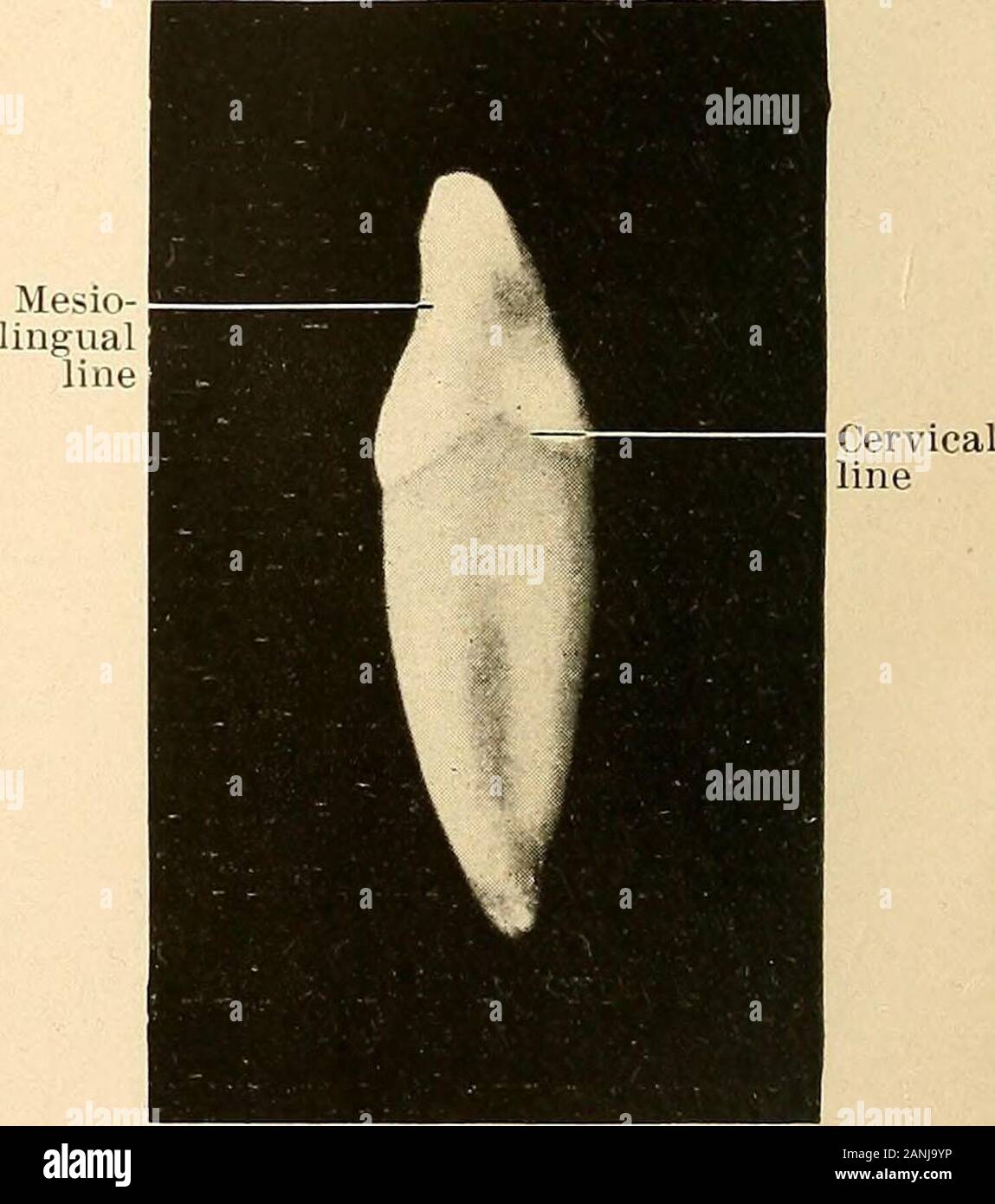 Principles and practice of operative dentistry . Fig. 23.—Inferior ...