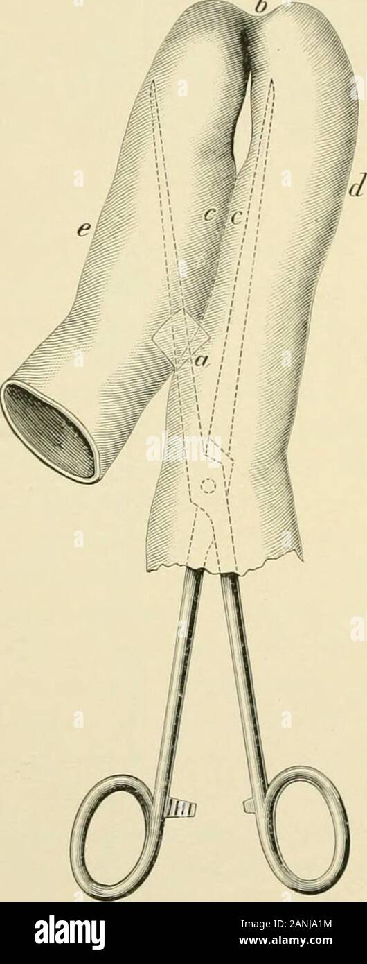 Kept in the loop hi-res stock photography and images - Alamy