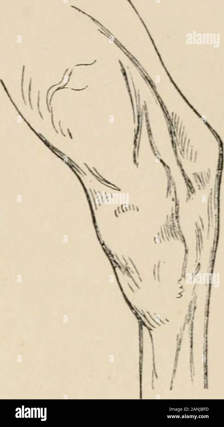 Horses and riding . Well-formed hock with curb. Curby hock without curb ...