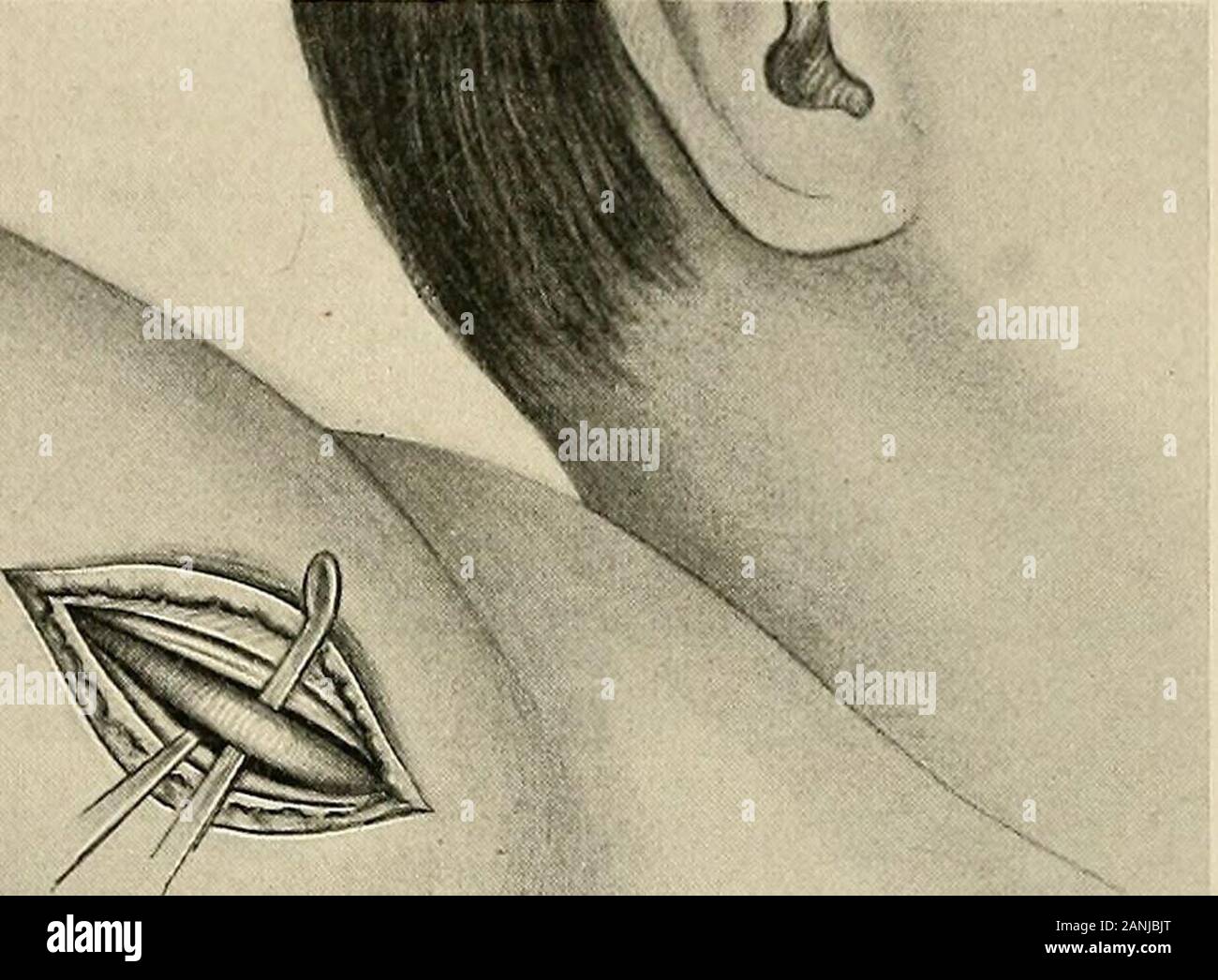 The practice of surgery . p in the technic. one might well follow ...