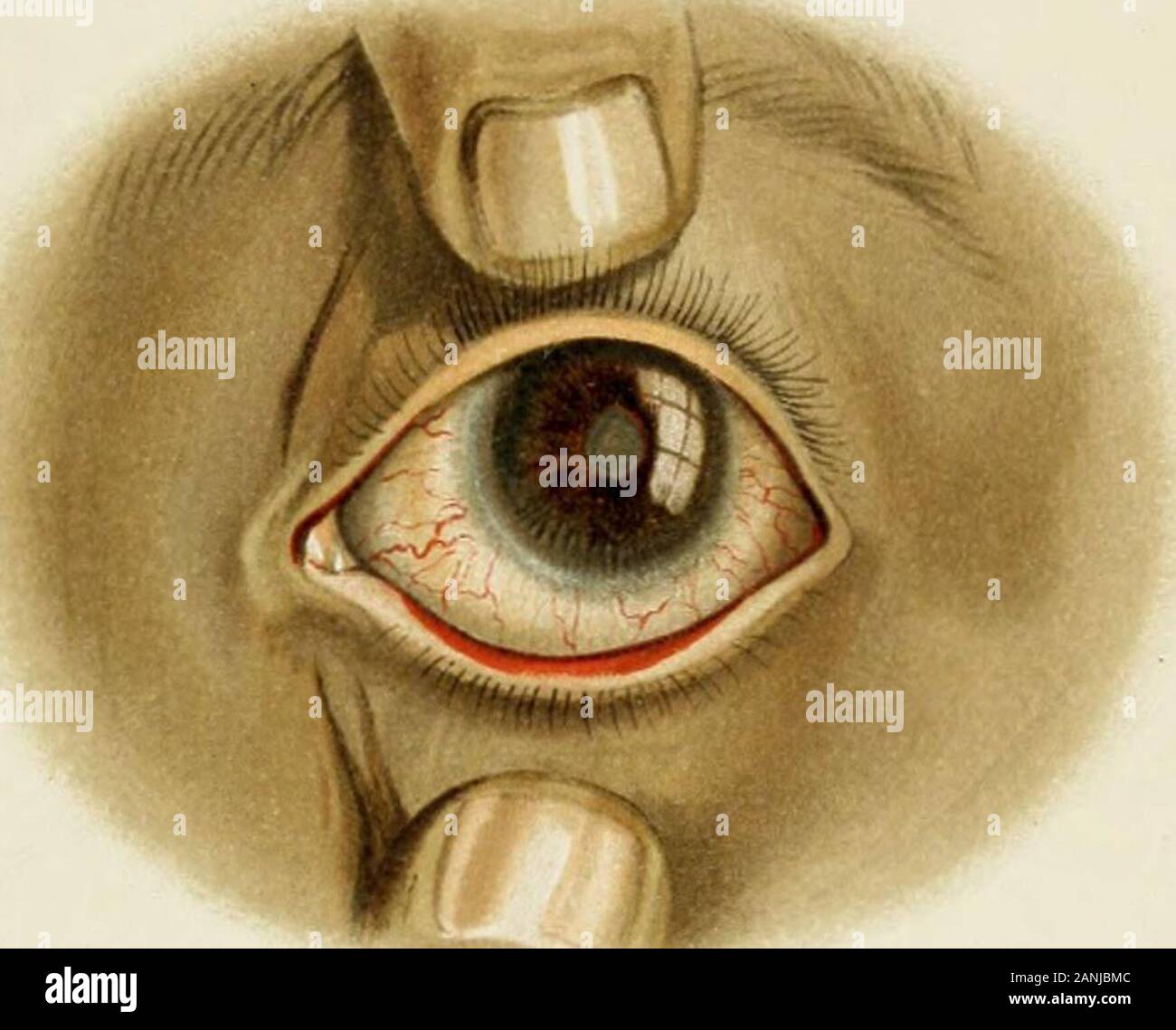 Eye injuries and their treatment Stock Photo - Alamy