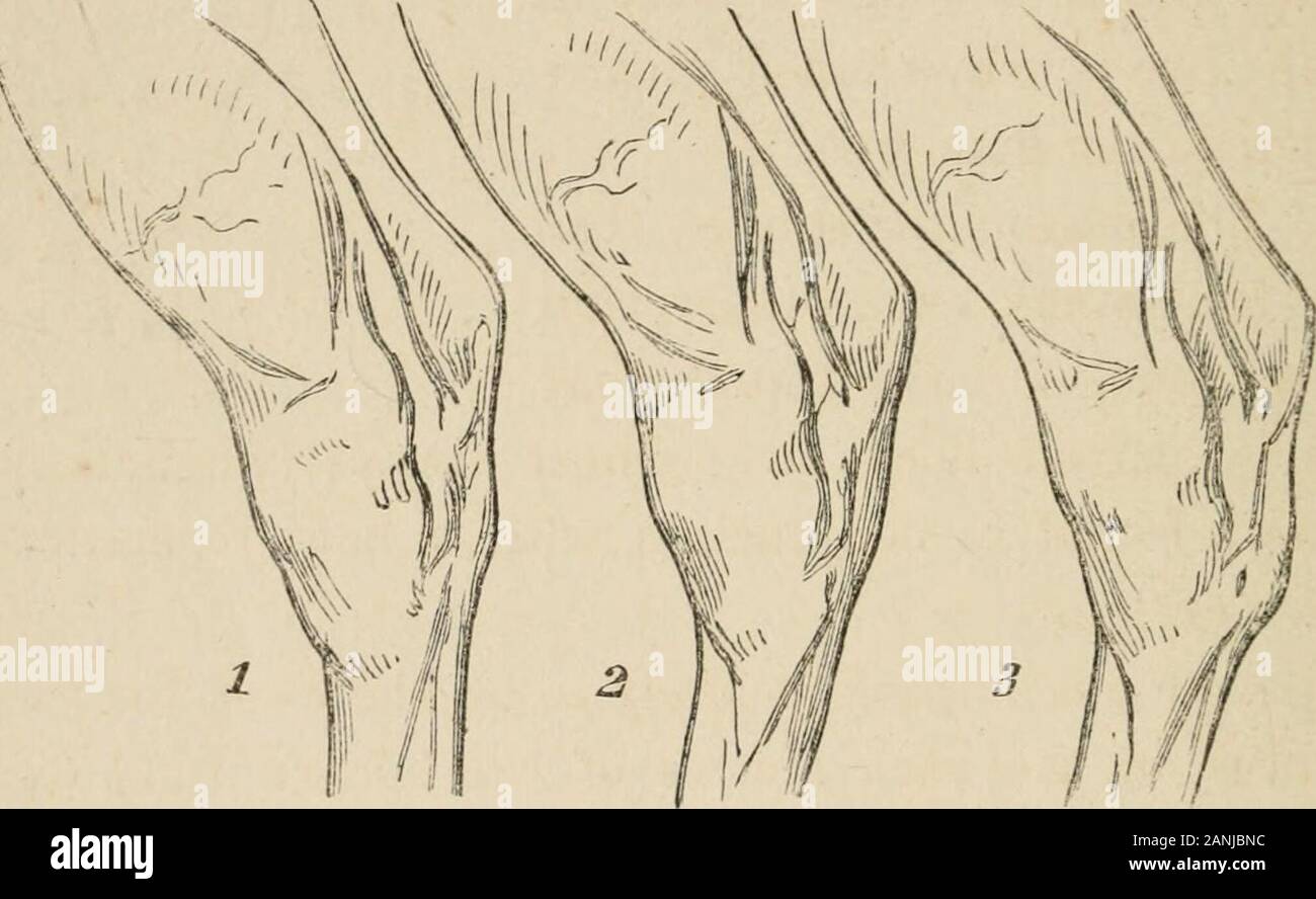 Curby hi-res stock photography and images - Alamy