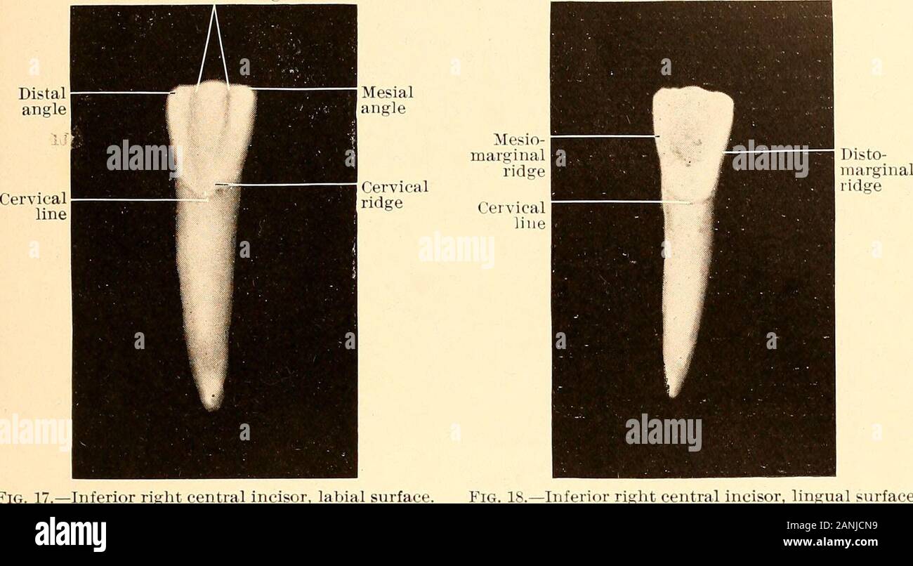 Cervical Line Tooth