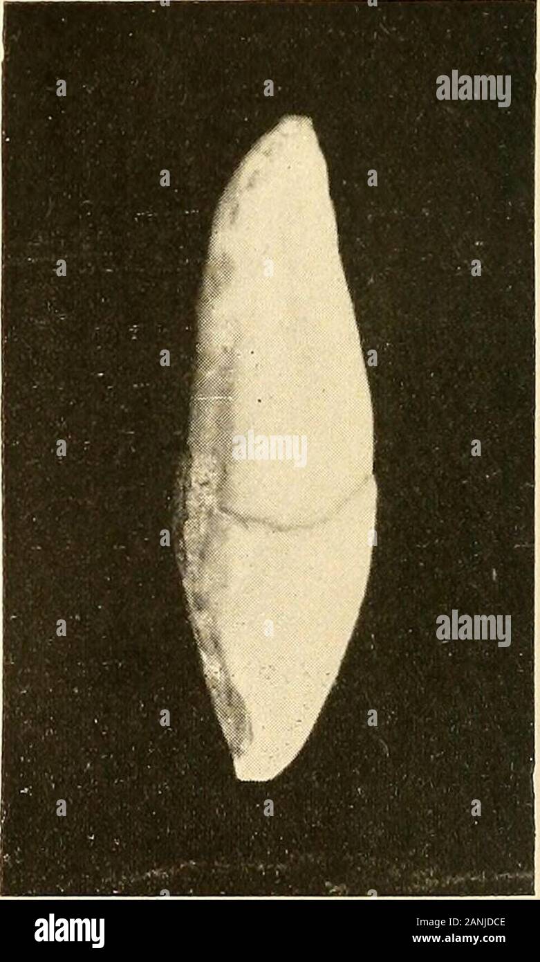 Principles and practice of operative dentistry . Fig. 15.—Superior ...