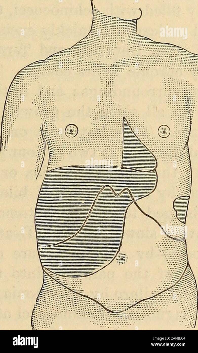 A treatise on the practice of medicine, for the use of students and ...