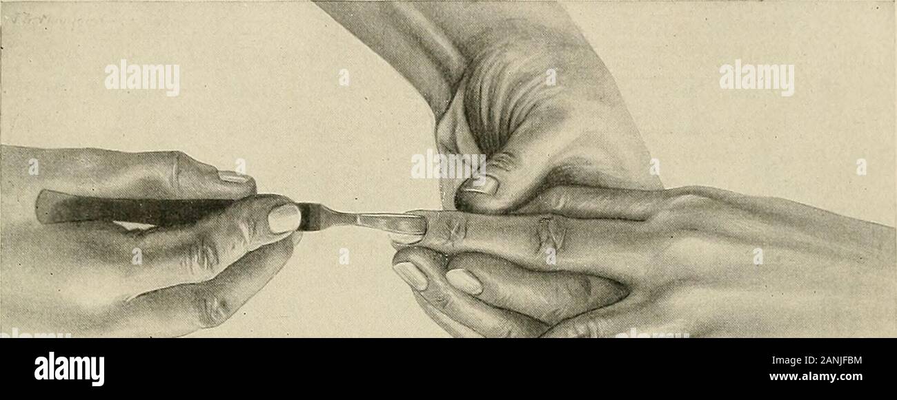 The practice of surgery . better results inthe treatment of these ...