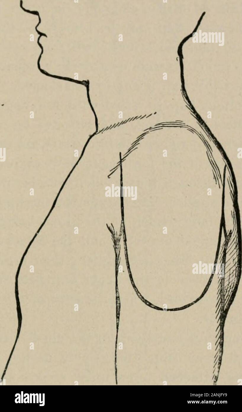 Operative surgery, for students and practitioners . Fig. 329.—Right ...