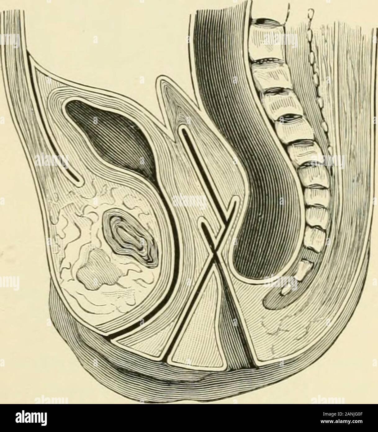 Sponge Forceps High Resolution Stock Photography and Images - Alamy