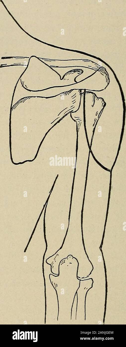 Operative surgery, for students and practitioners . ^ from the outer ...