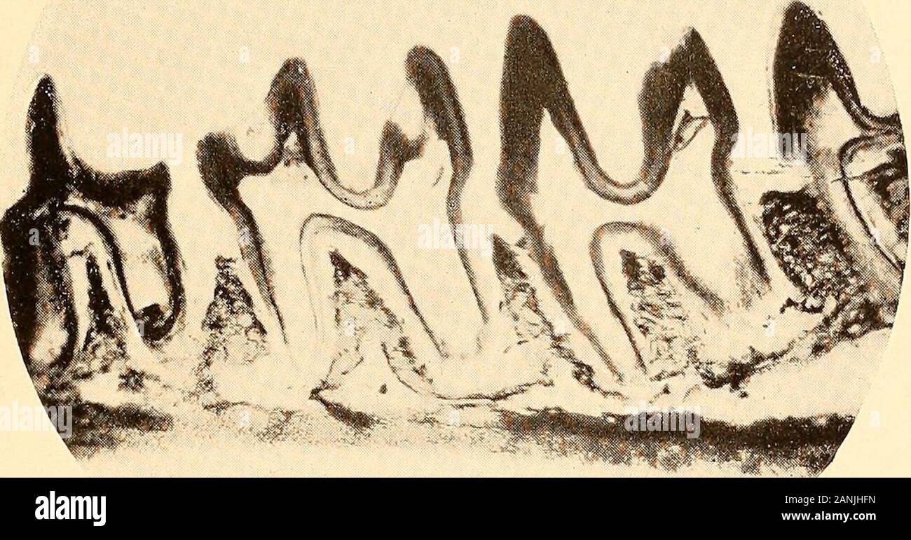 Principles and practice of operative dentistry . Permanent teeth of the ...