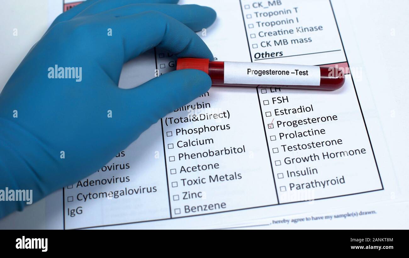 Progesterone, doctor showing blood sample in tube, lab research, health ...