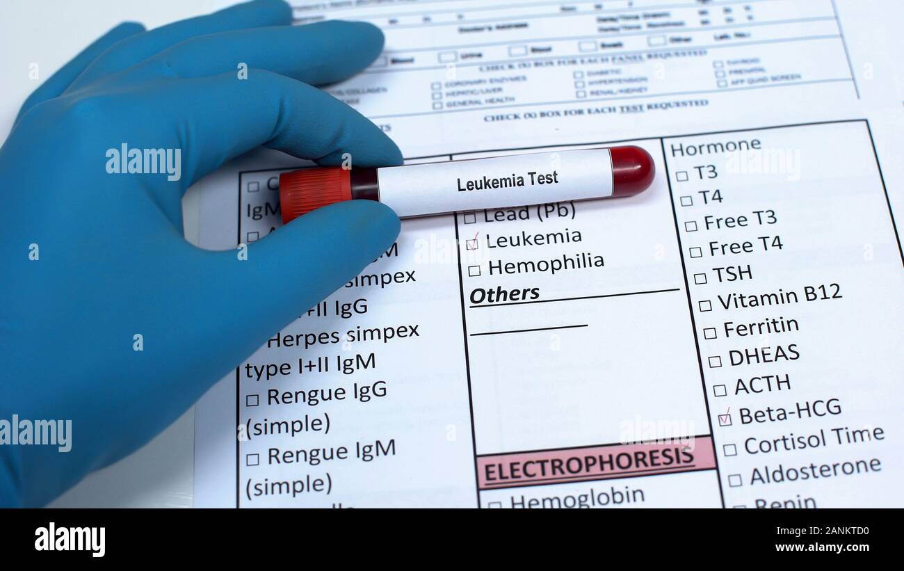 Leukemia test, doctor showing blood sample in tube, lab research ...