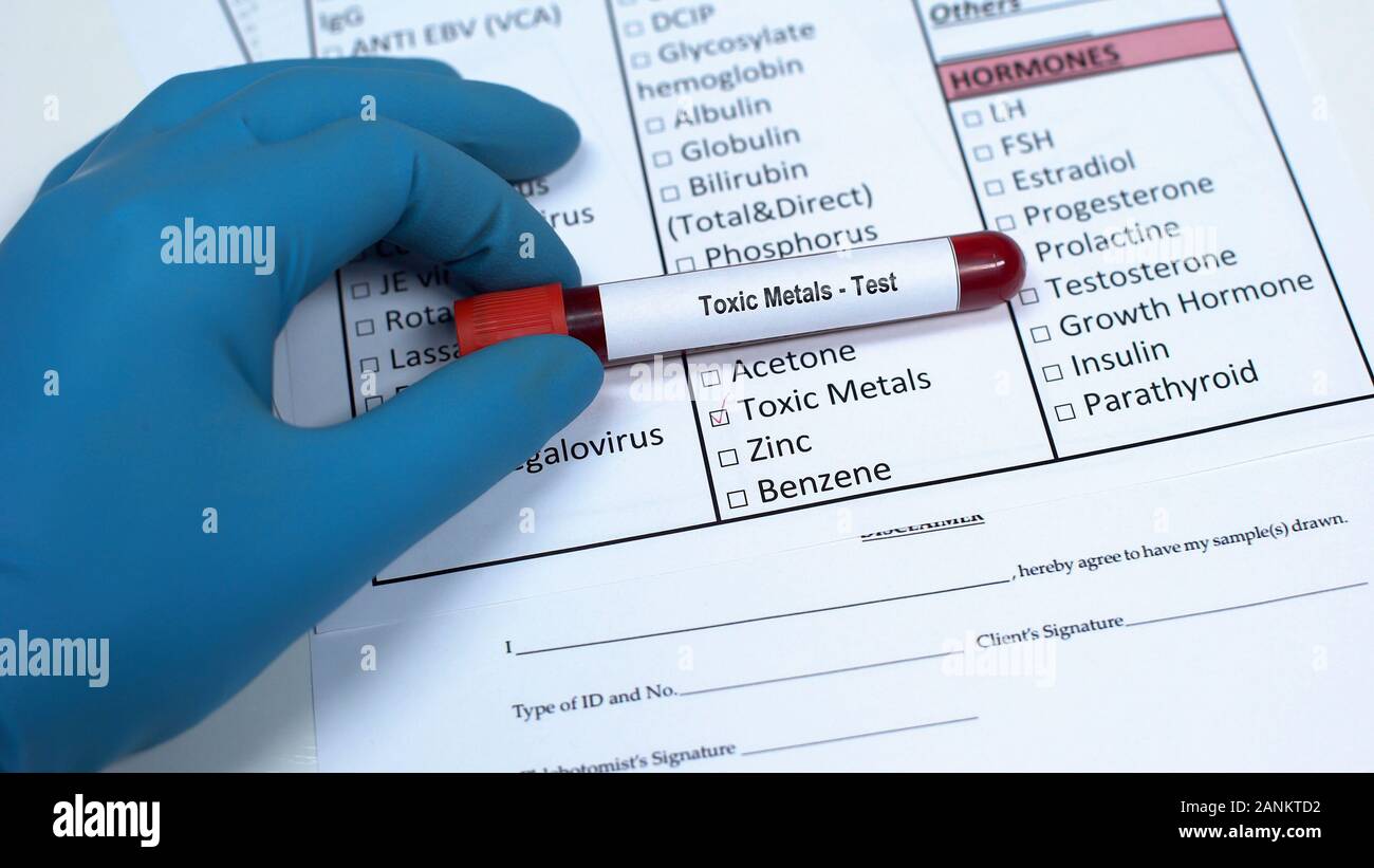 Toxic metals, doctor showing blood sample in tube, lab research, health ...