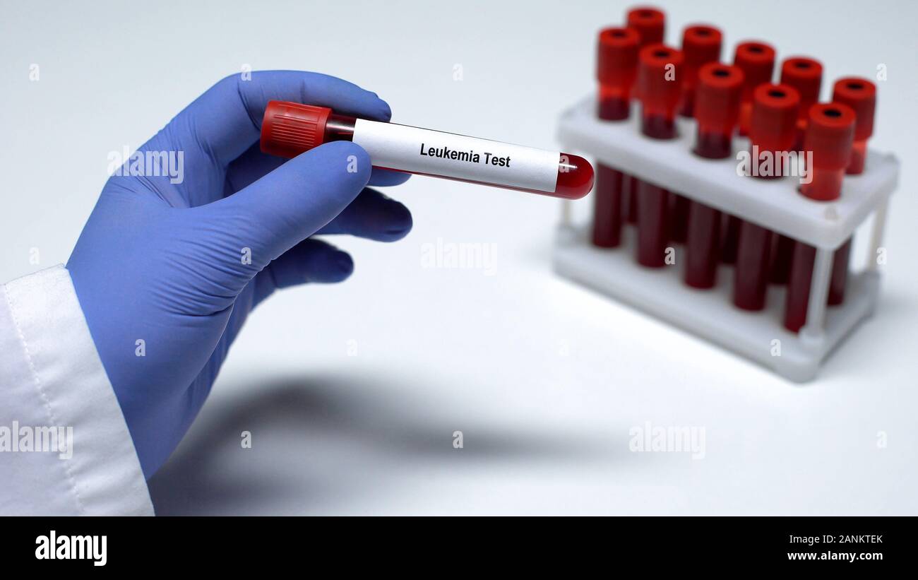 Leukemia test, doctor showing blood sample in tube, lab research ...