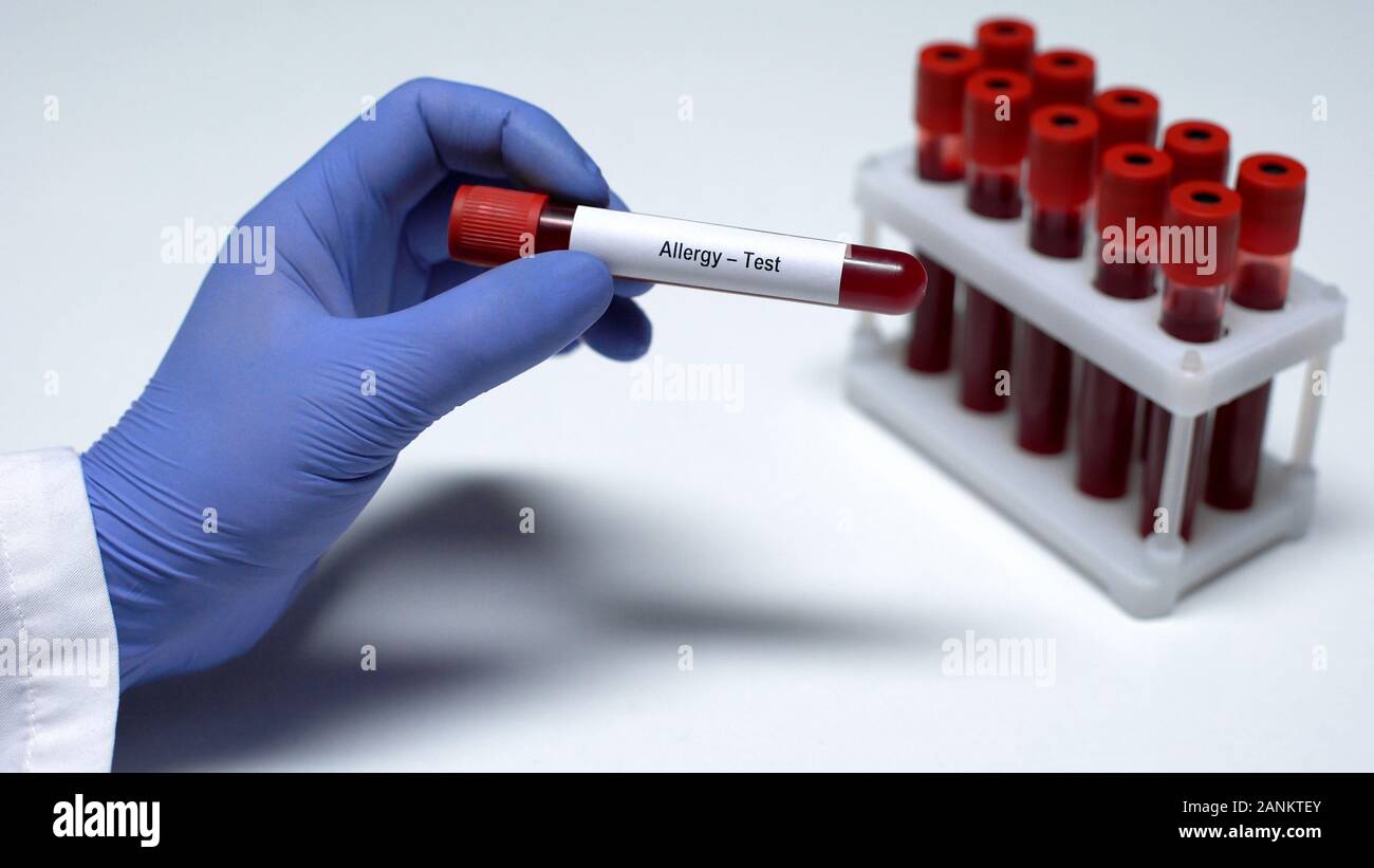 Allergy test, doctor showing blood sample in tube, lab research, health ...