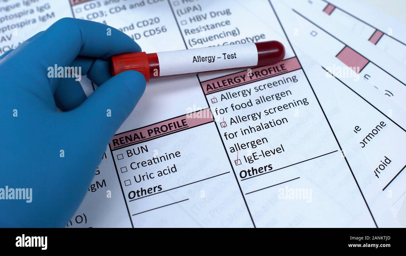 Allergy, doctor showing blood sample in tube, positive test results in ...