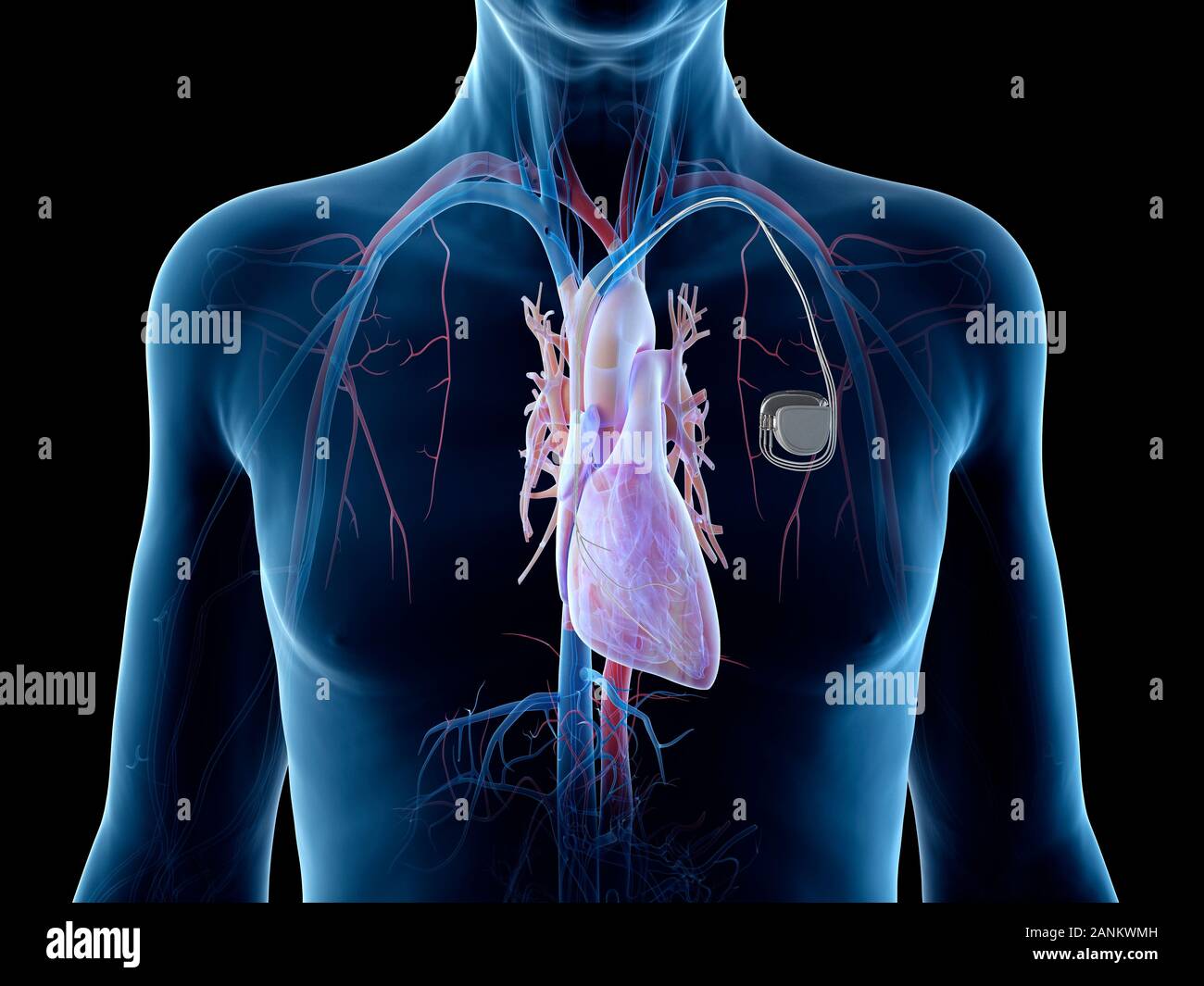 Illustration of an old man with a pace maker Stock Photo - Alamy