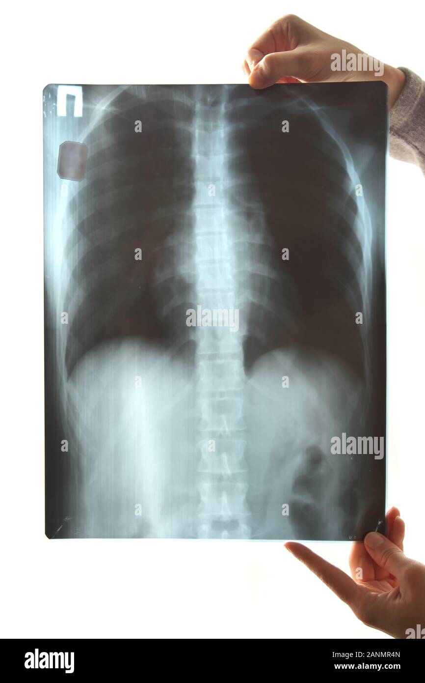 Doctor holding a RX, isolated over a white background Stock Photo - Alamy