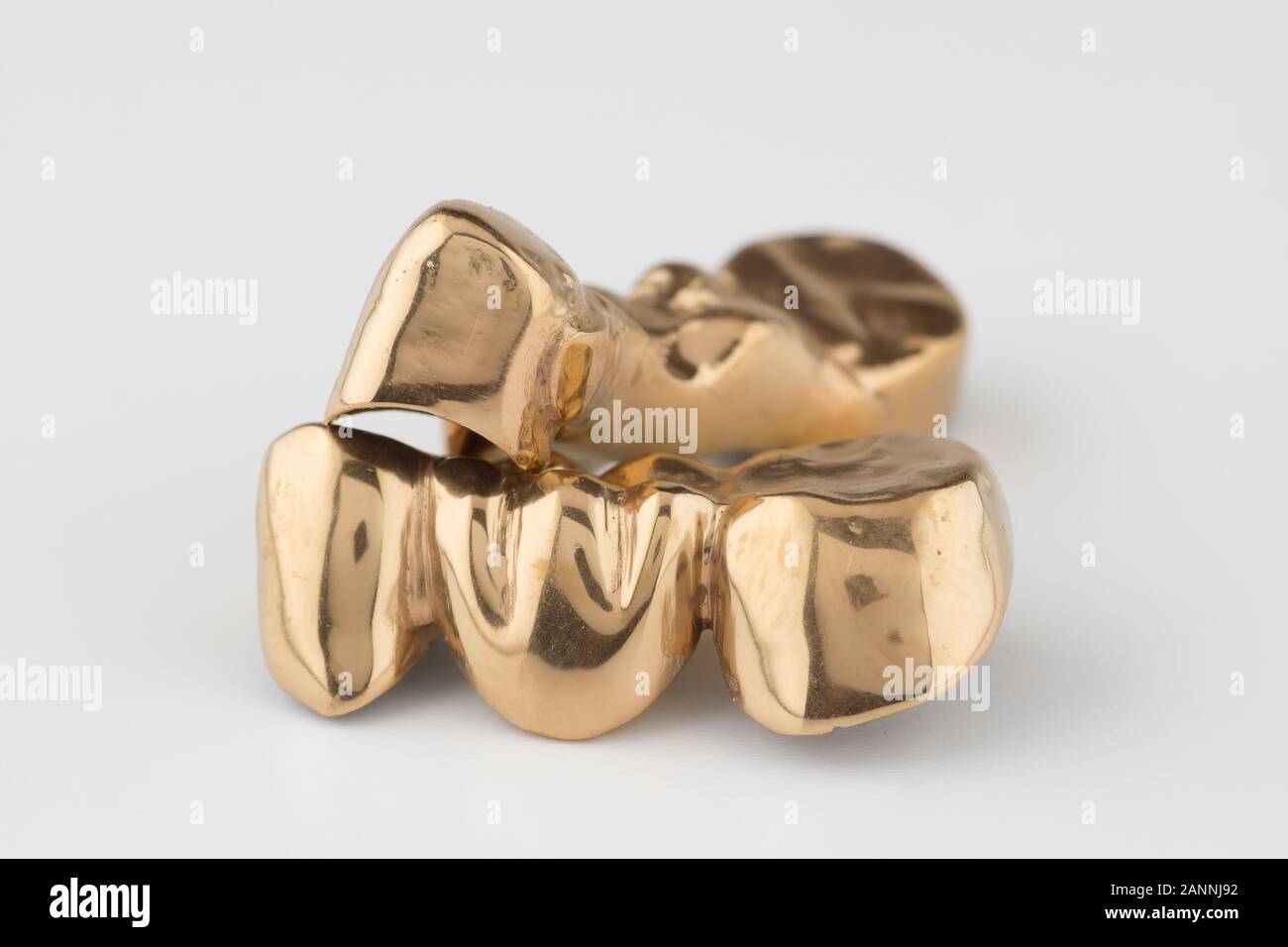 Steel artificial dental crown for dentition restoration Stock Photo - Alamy