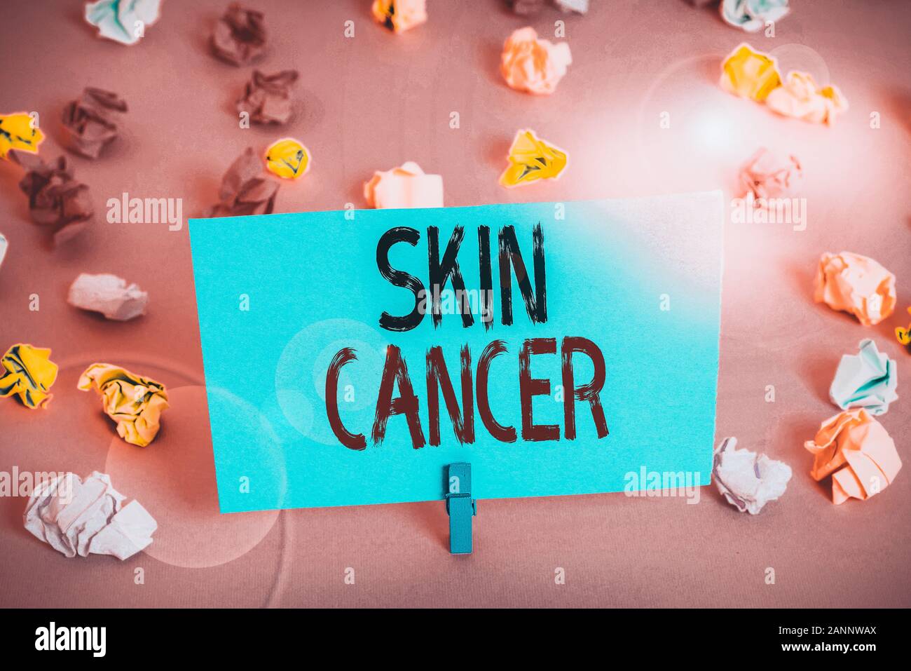 Handwriting text Skin Cancer. Conceptual photo uncontrolled growth of ...