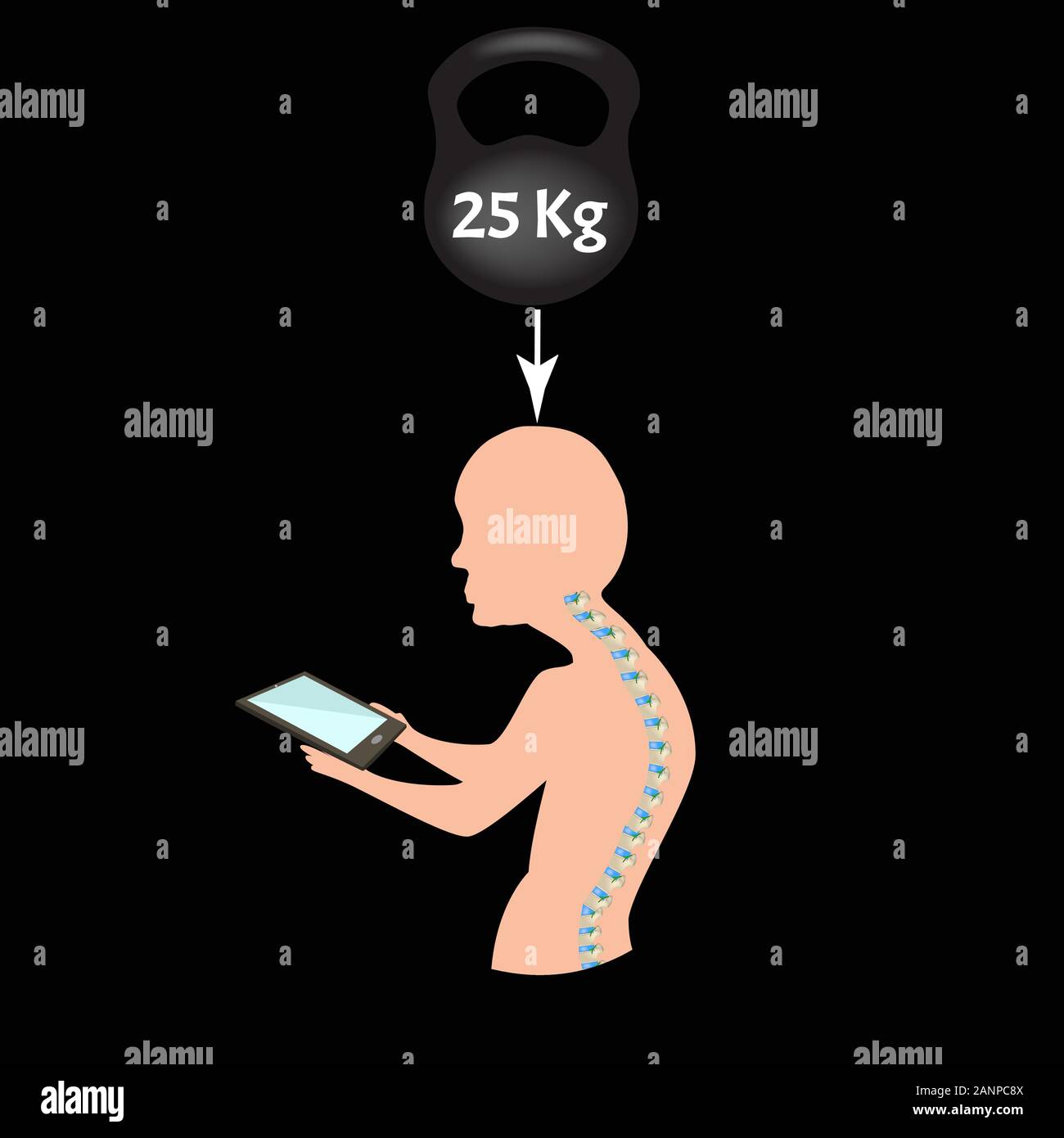 Improper Posture Symptoms Text Neck Syndrome Spinal Curvature