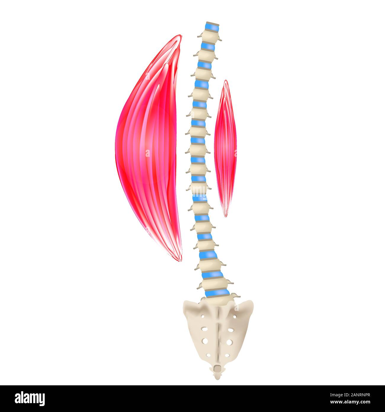 Left-sided scoliosis. Levoscoliosis. Muscles and spine. Spinal ...