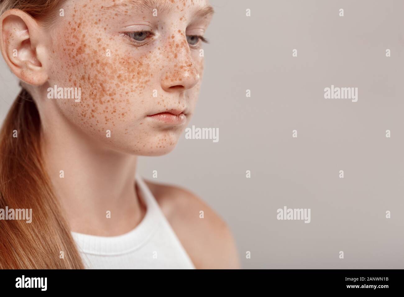 Inclusive Beauty. Girl with freckles standing isolated on grey looking ...