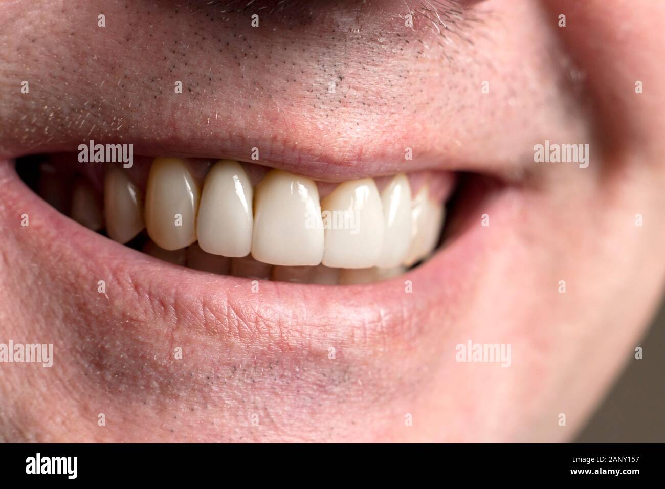 Close-up smile of an unshaven man. Soft focus Stock Photo - Alamy