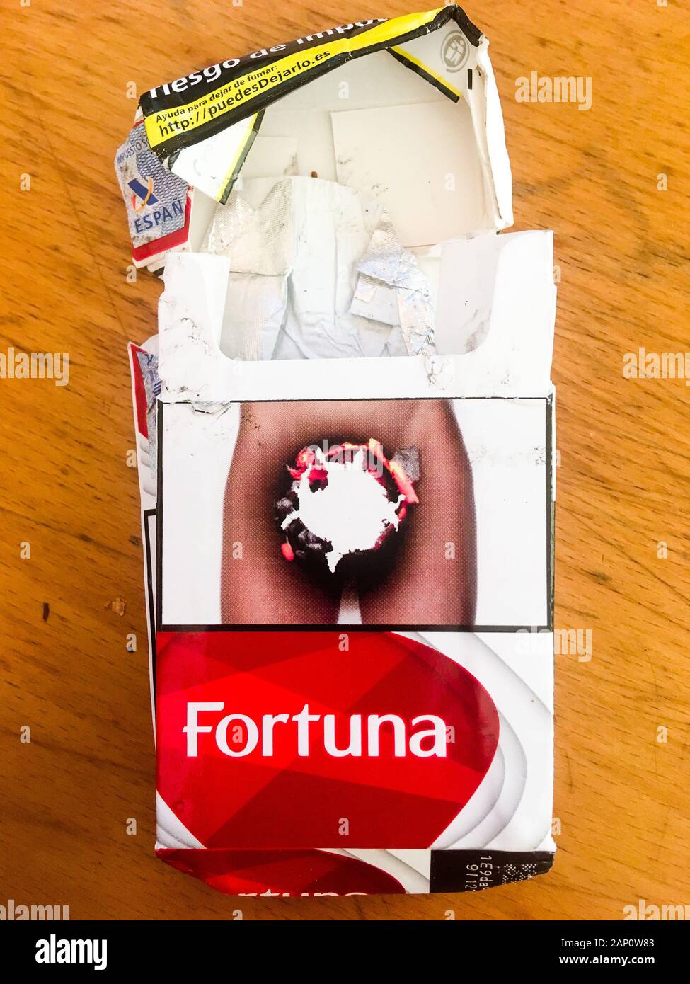 Cancer de la gorge hi-res stock photography and images - Alamy