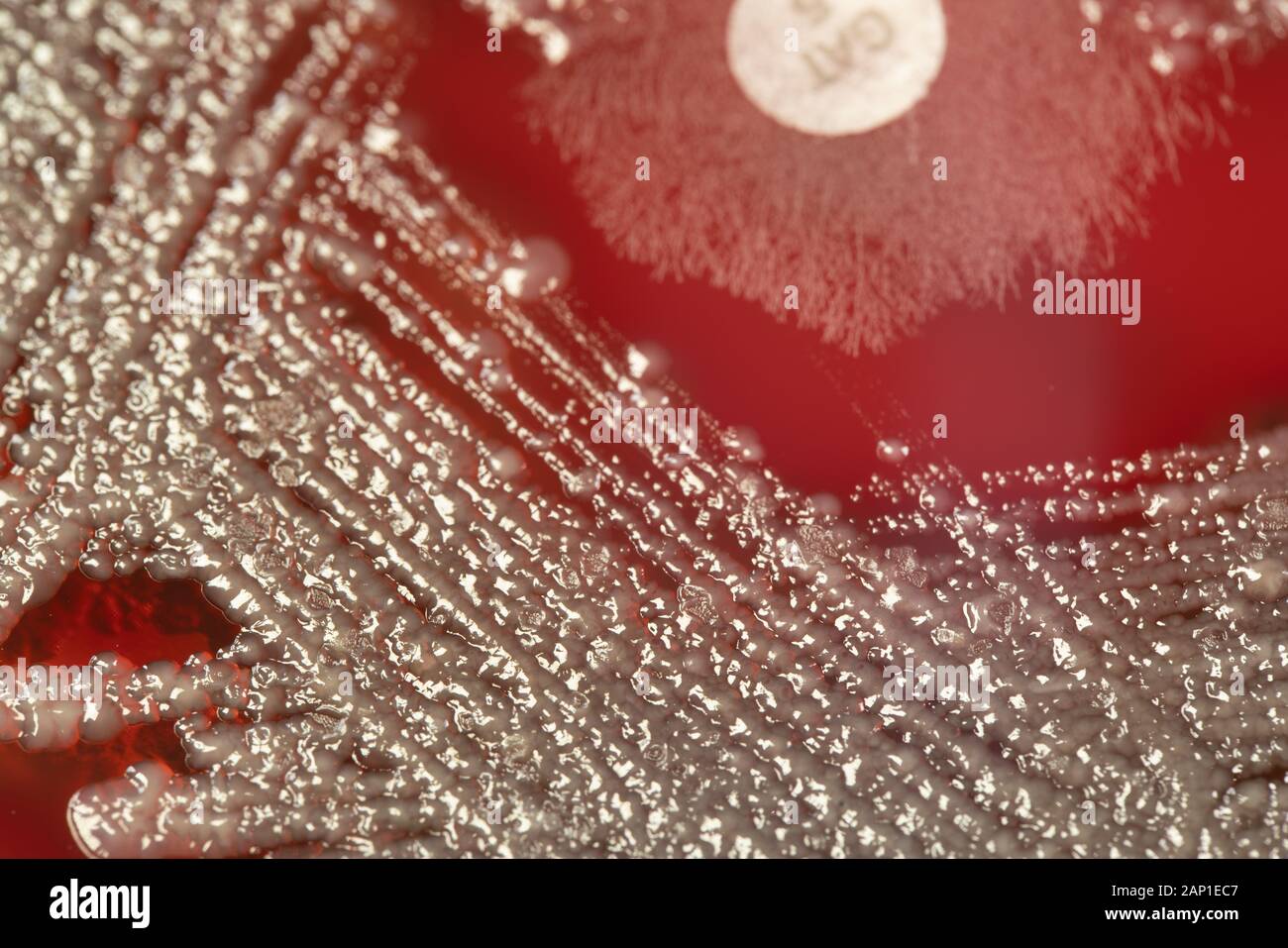 Sowing human feces in a petri dish Stock Photo - Alamy